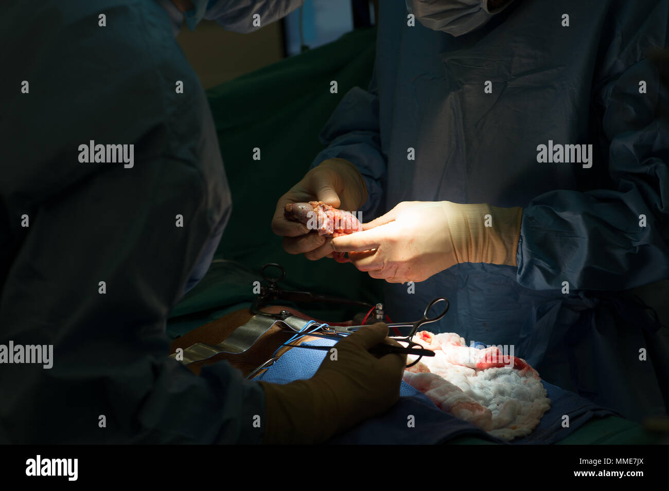 Organ transplant hi-res stock photography and images - Alamy