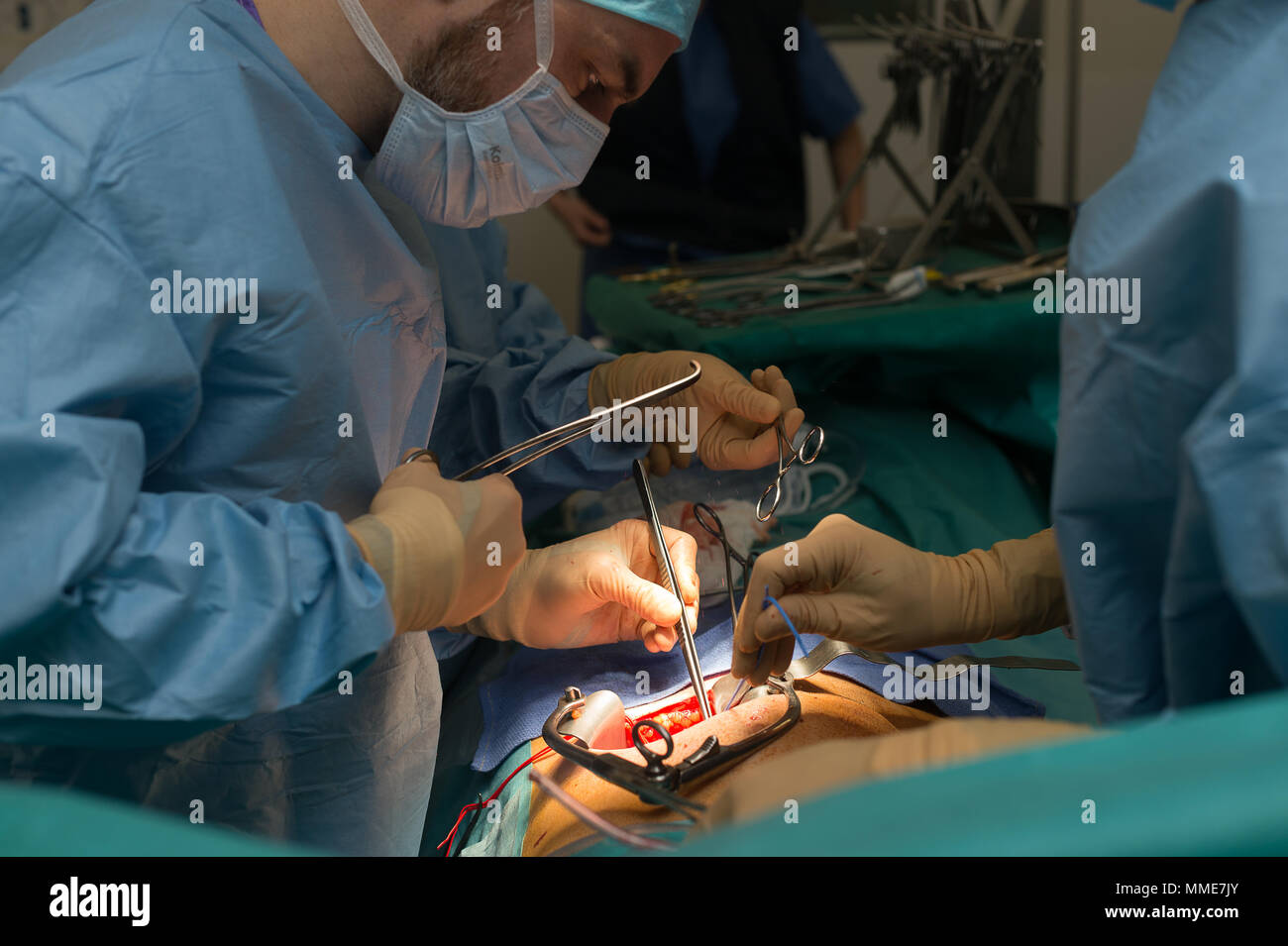Health hospital operating theatre transplants hi-res stock photography ...