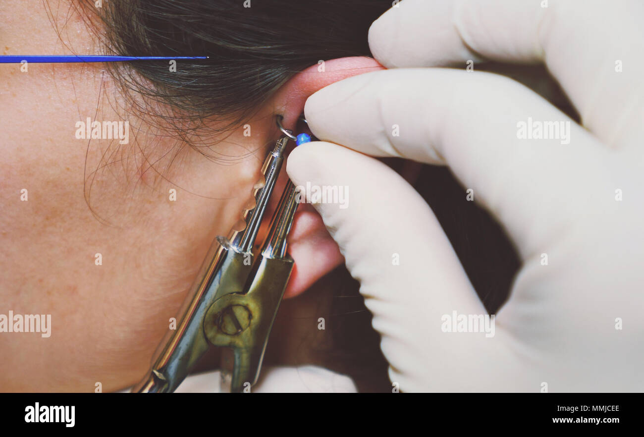 Numbing cream hi-res stock photography and images - Alamy