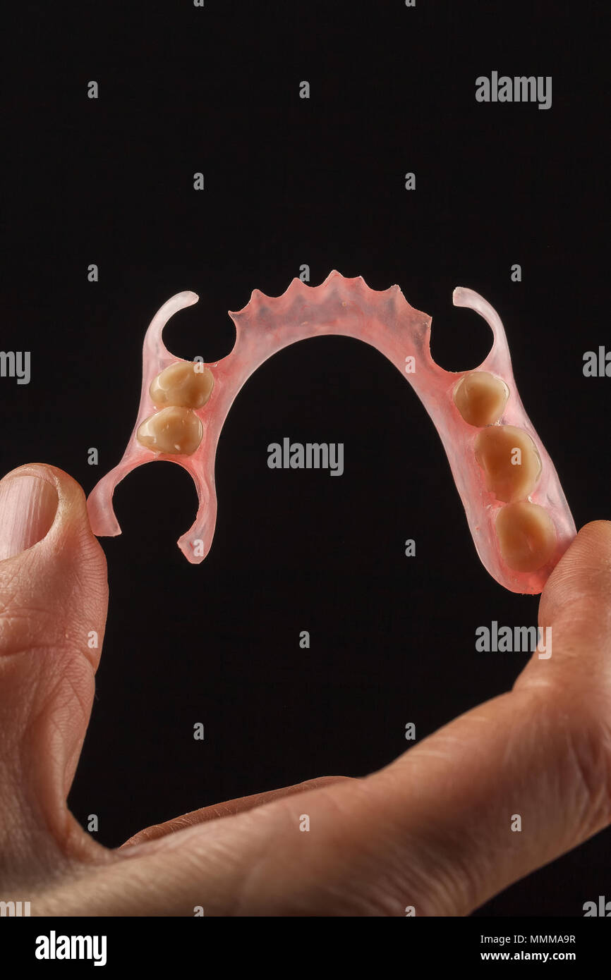Removable dental prosthesis hi-res stock photography and images - Alamy