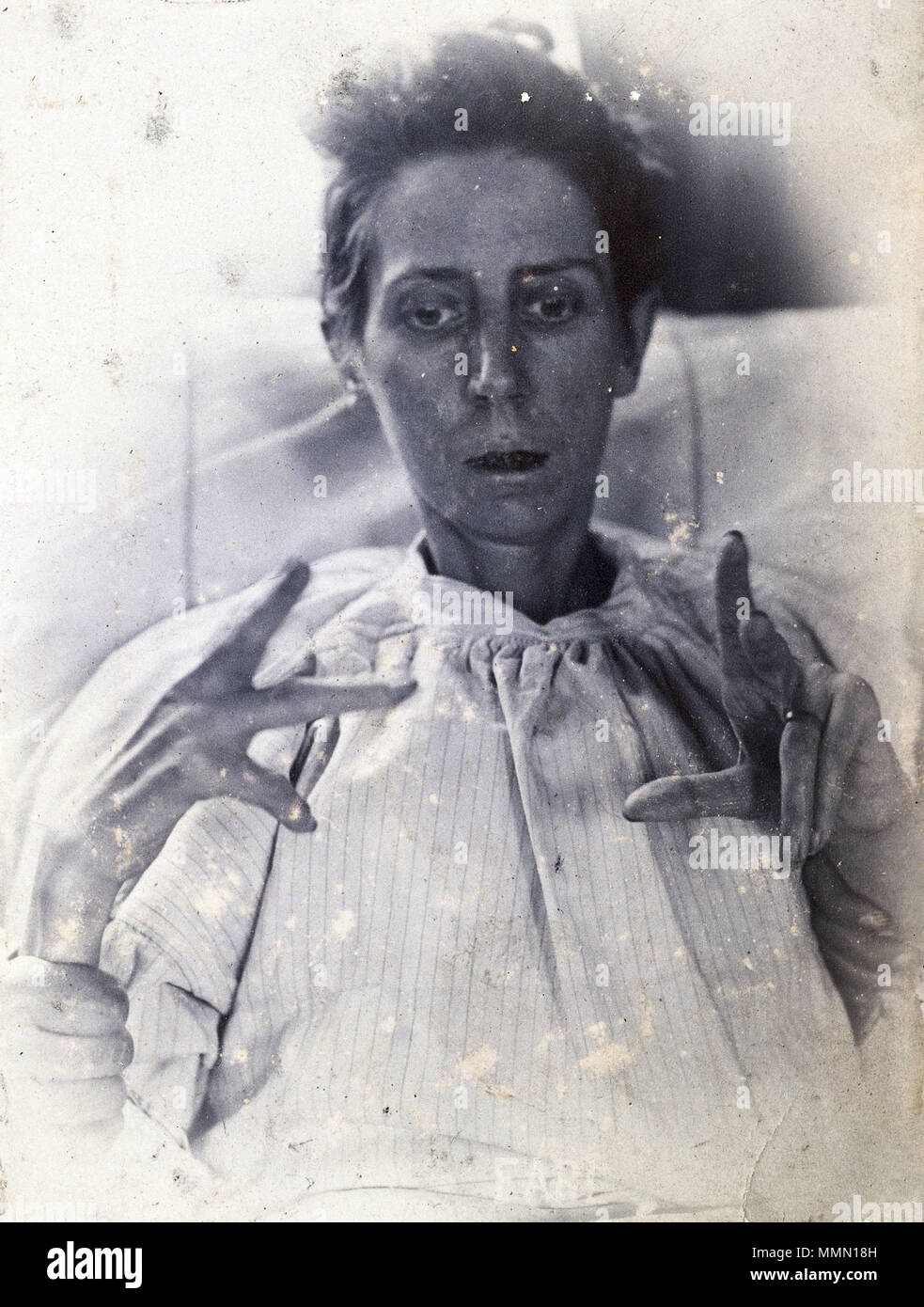 . Iconographic Collections. Keywords: Friern Hospital (London) A woman ...