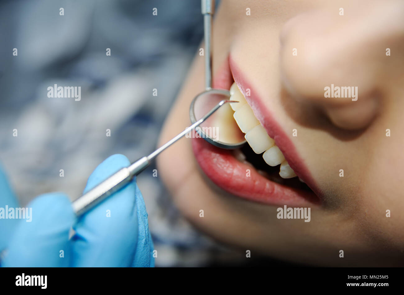 teeth of a beautiful girl closeup Stock Photo - Alamy
