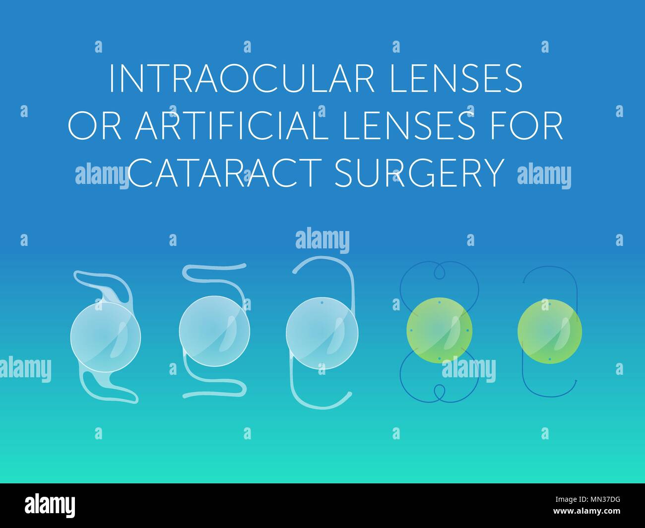 set of species Intraocular lenses or artificial lenses for cataract ...