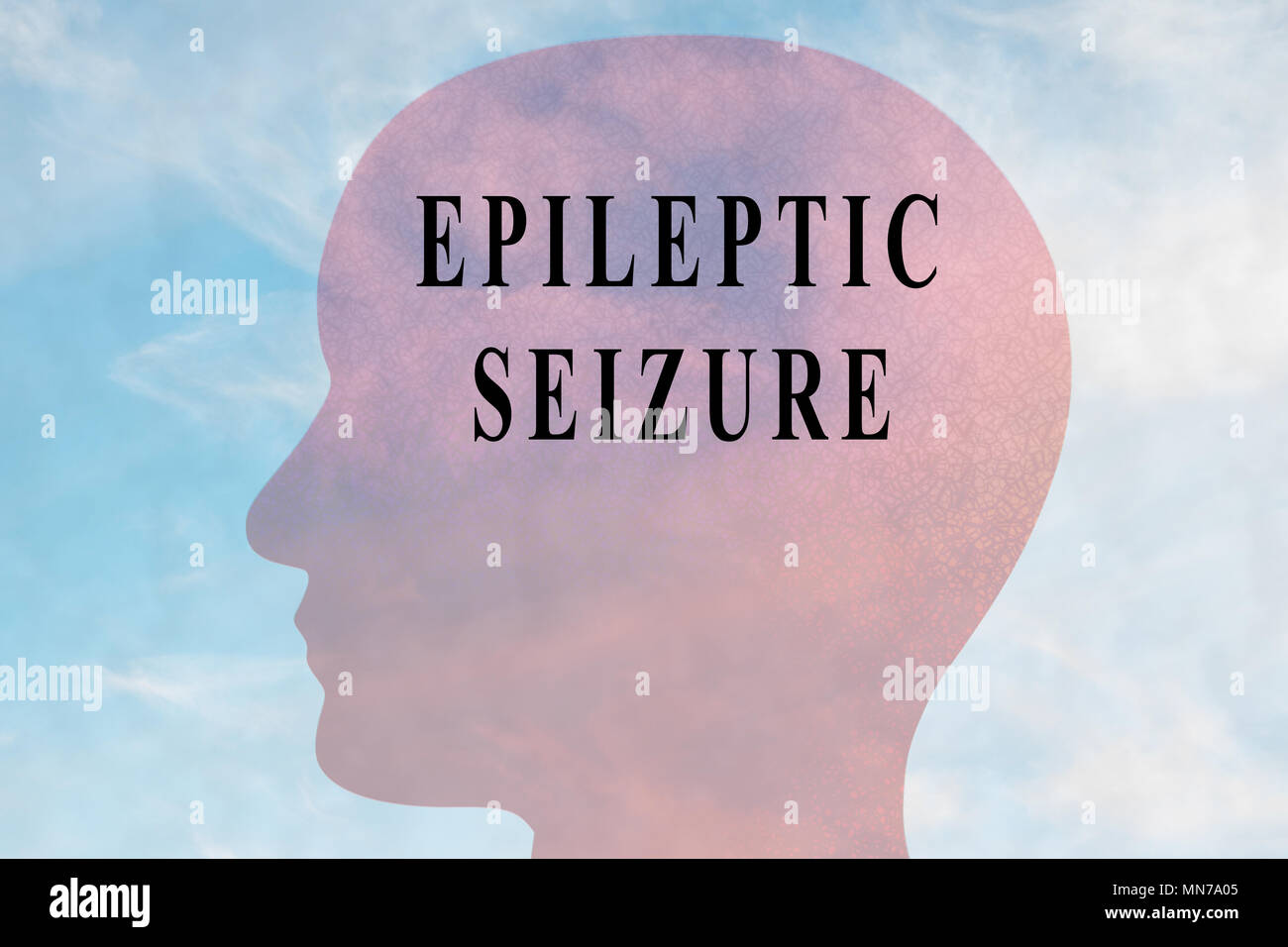 Render illustration of EPILEPTIC SEIZURE title on head silhouette, with ...
