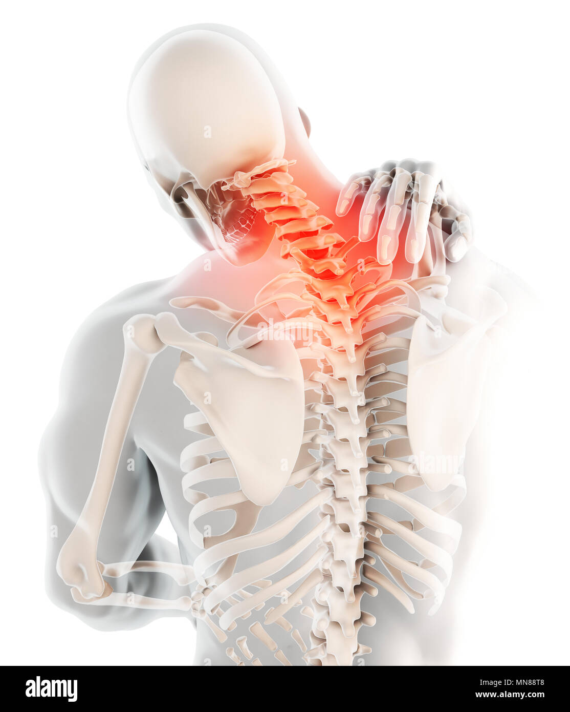 3D illustration, neck painful - cervical spine skeleton x-ray, medical ...