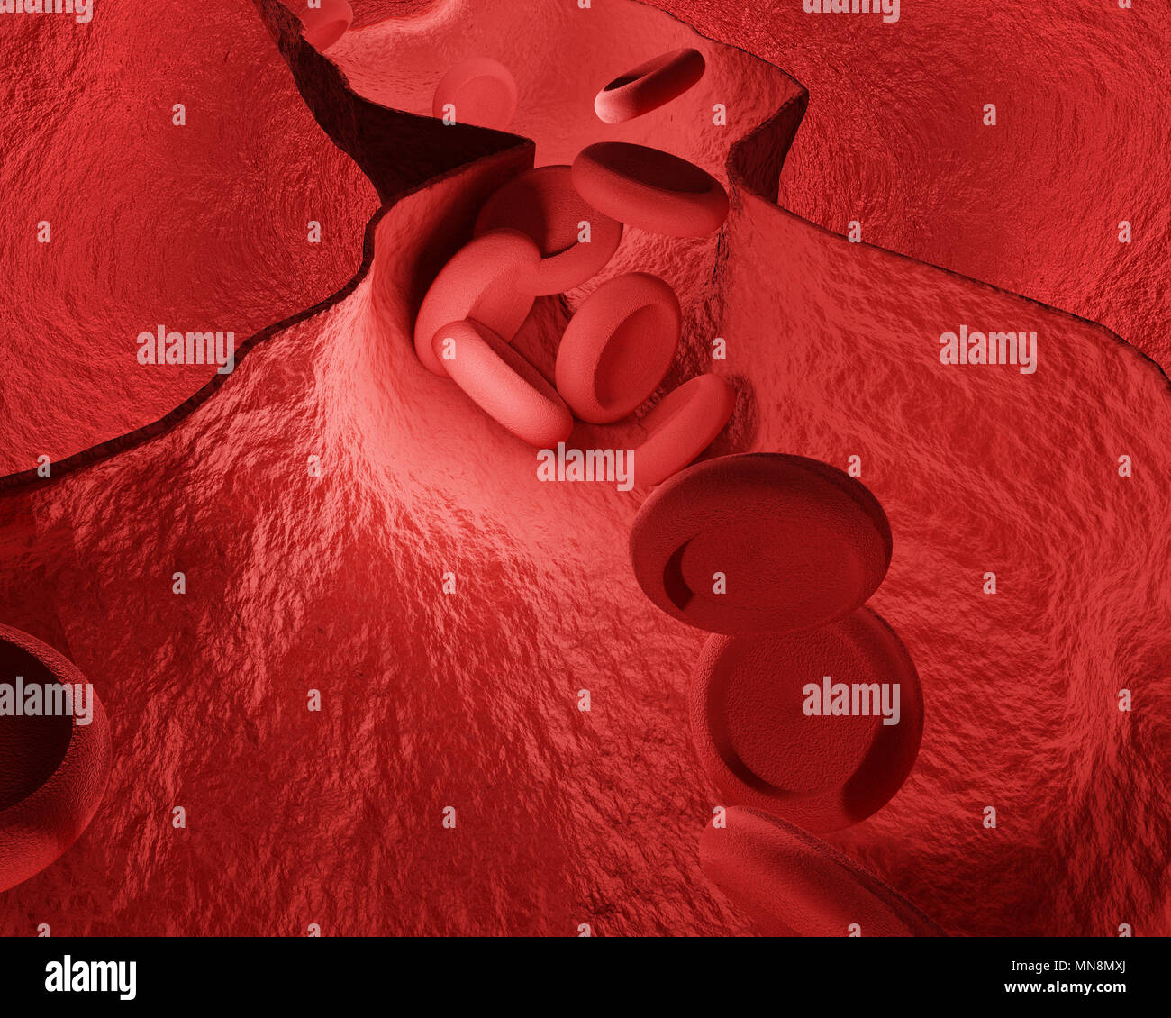 Coronary artery narrows hi-res stock photography and images - Alamy