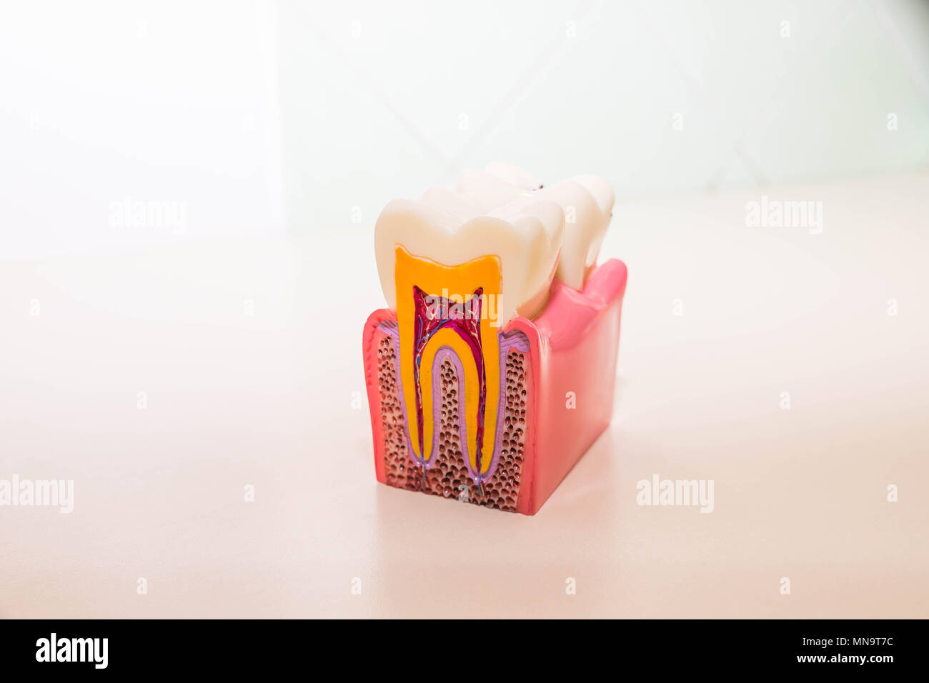 tooth model without caries, tooth decay in dentist's office. Healthy ...