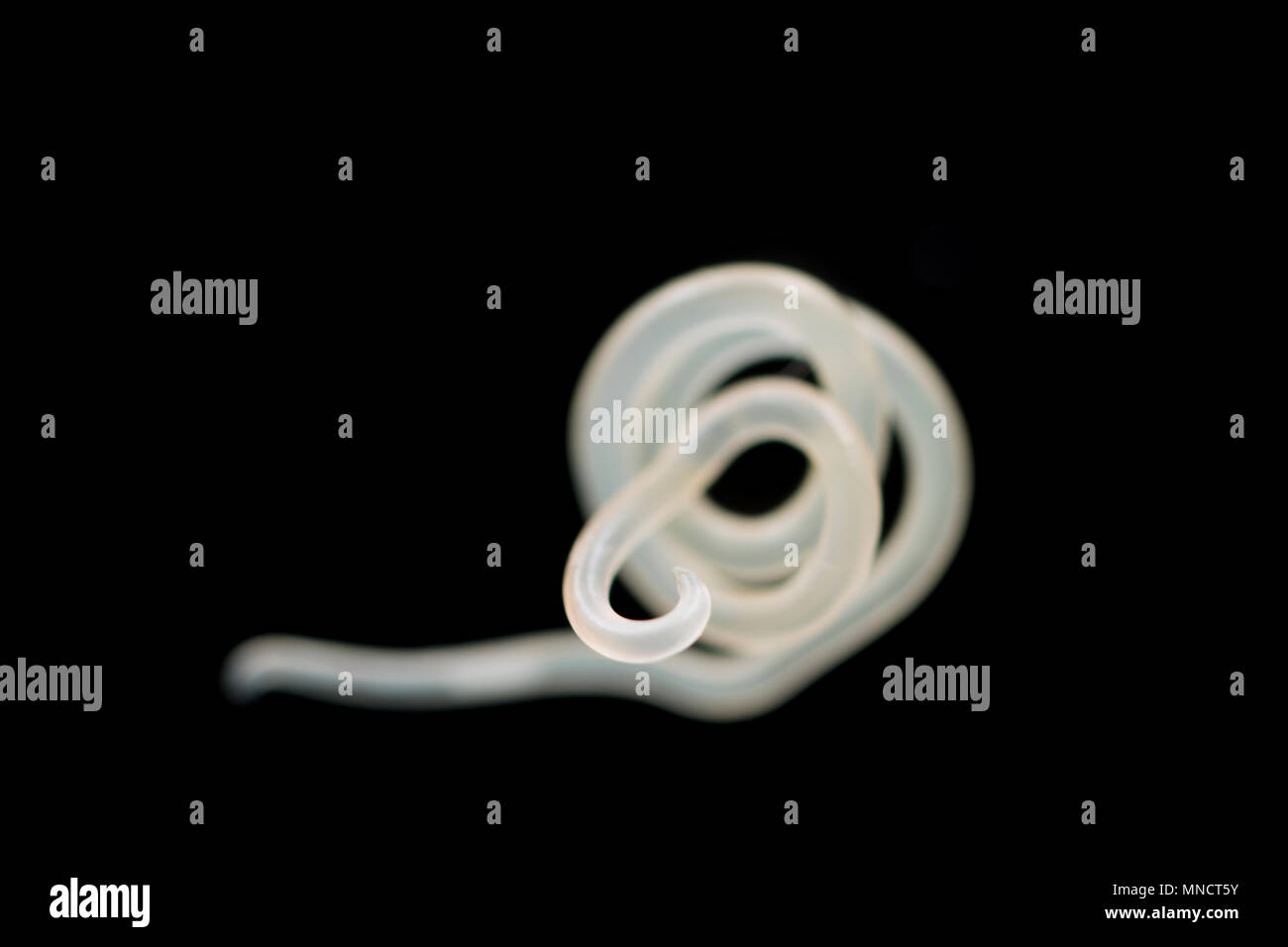 Anisakis worm hi-res stock photography and images - Alamy