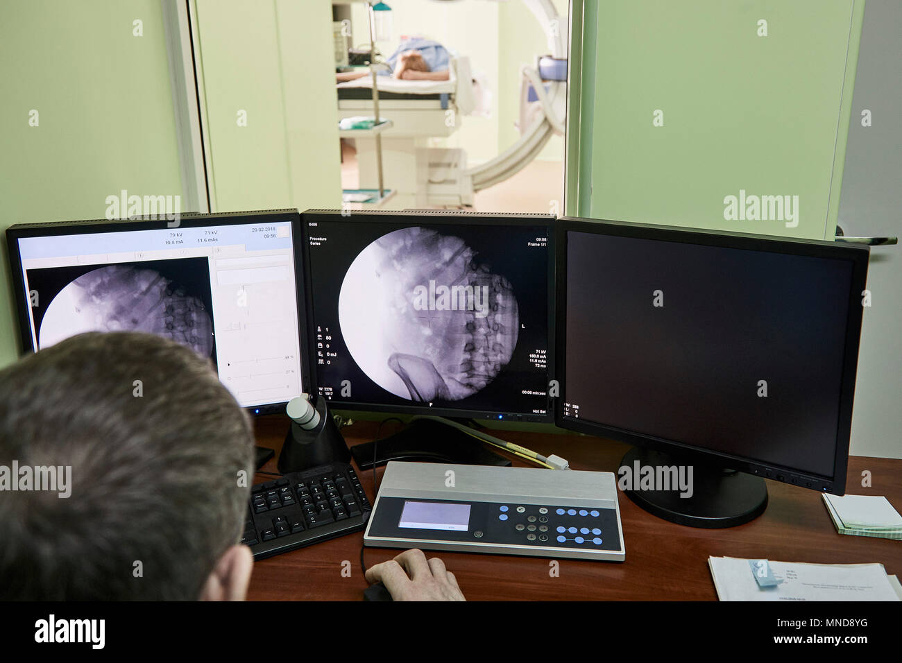 Doctor examining x rays in hi-res stock photography and images - Alamy