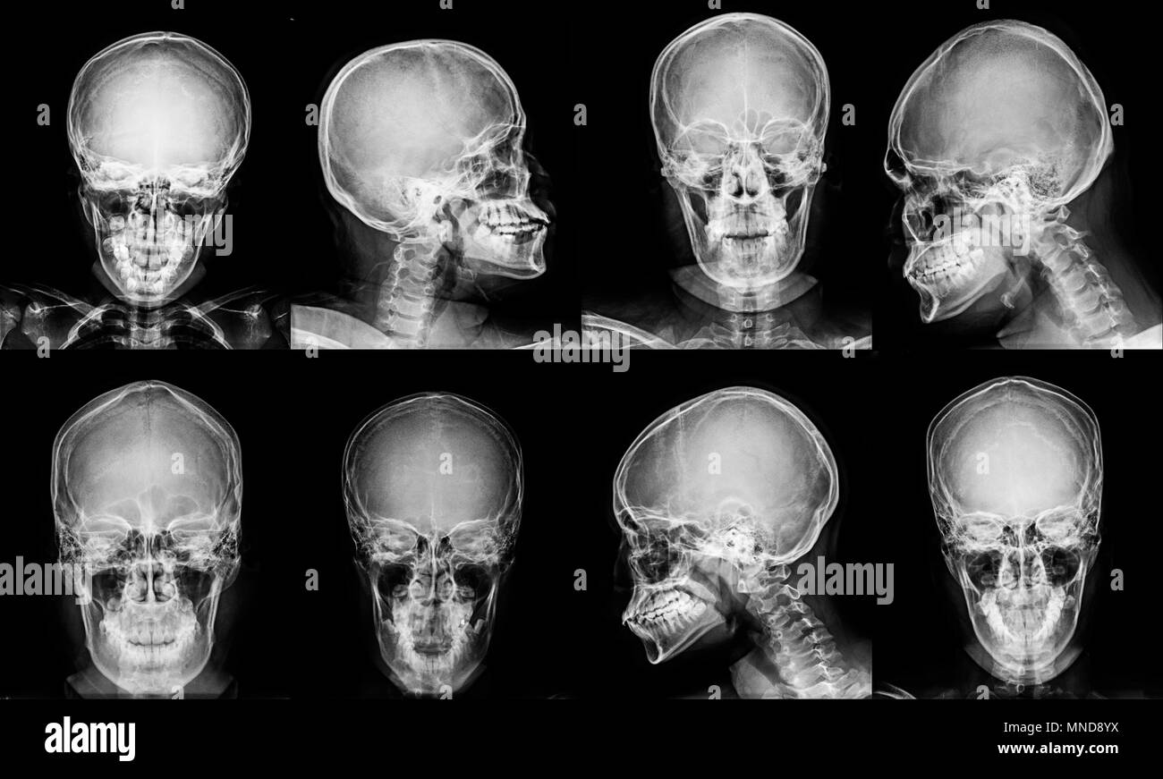 Front view gray side Black and White Stock Photos & Images - Alamy