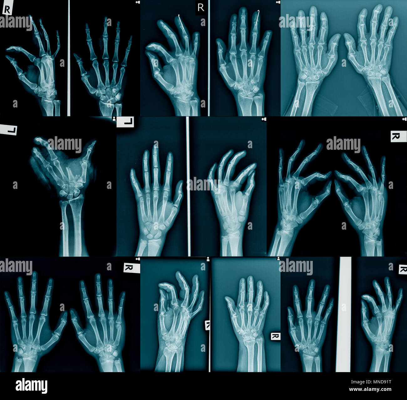 Skeleton Hand Pointing High Resolution Stock Photography and Images - Alamy