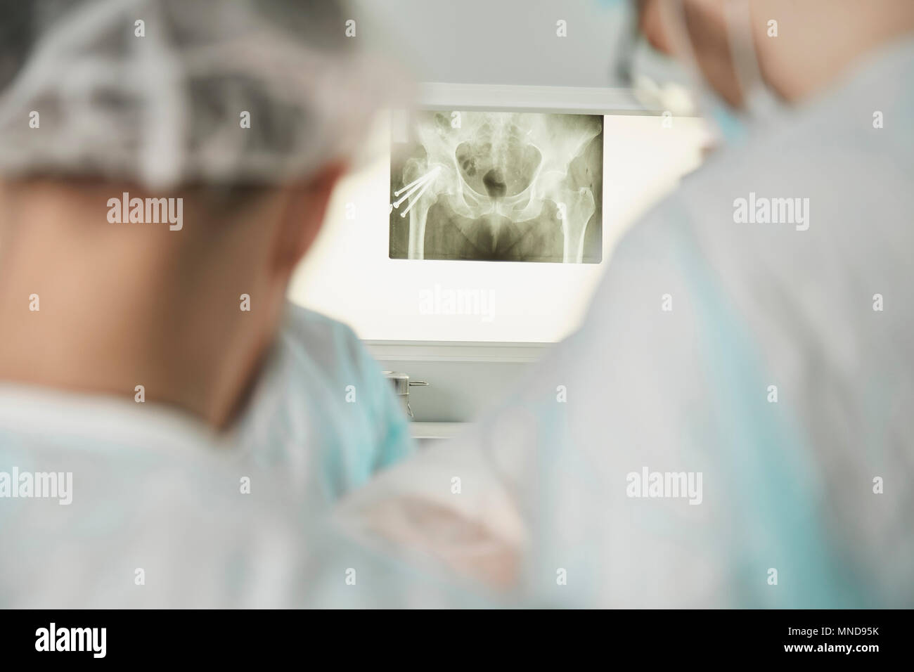 Surgical team against medical x-ray on screen in operating room Stock ...