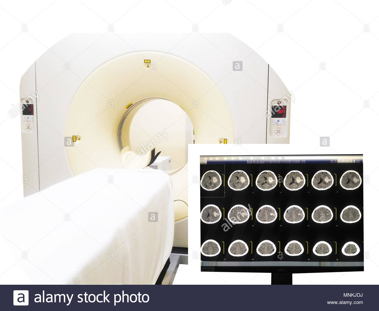 Computed Tomography Stock Photos & Computed Tomography Stock Images - Alamy