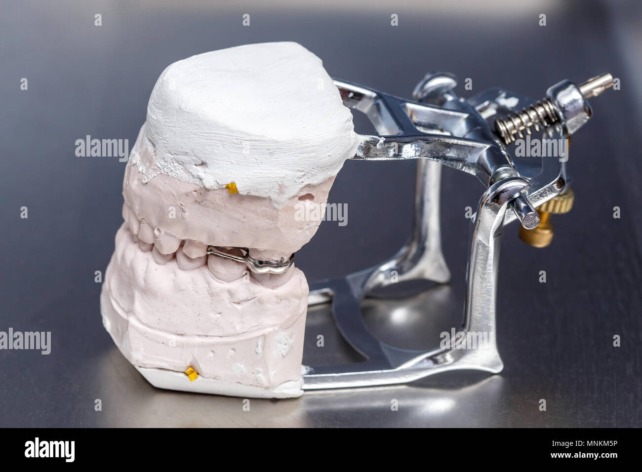 Gray dental prosthesis teeth mold, clay human gums model in jaws ...