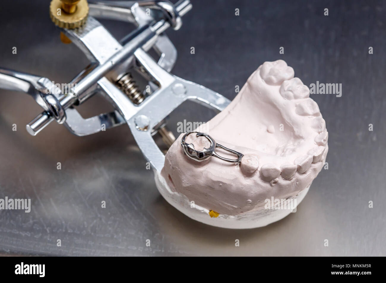 Gray dental prosthesis teeth mold, clay human gums model in jaws ...