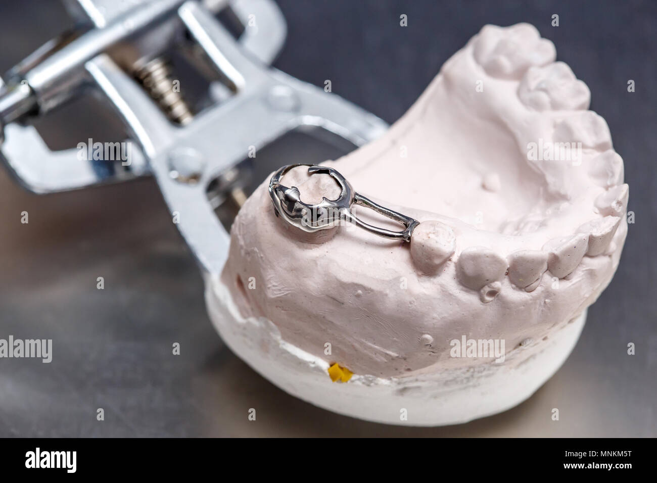 Gray dental prosthesis teeth mold, clay human gums model in jaws ...