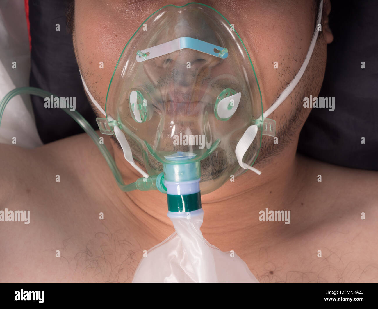 closeup of male patient wearing oxygen mask Stock Photo - Alamy