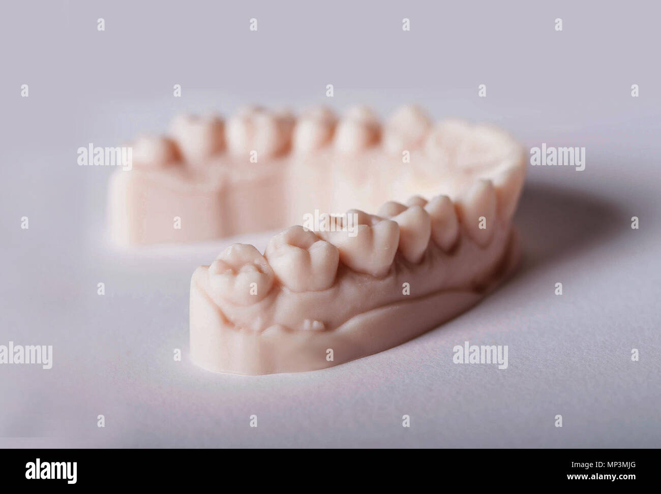 Implants dental hi-res stock photography and images - Alamy
