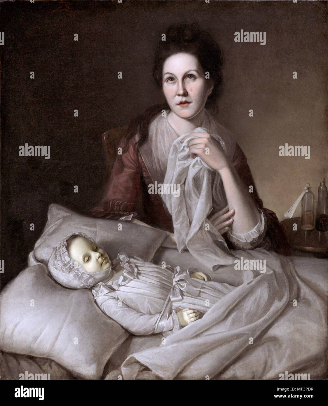 Smallpox hi-res stock photography and images - Alamy