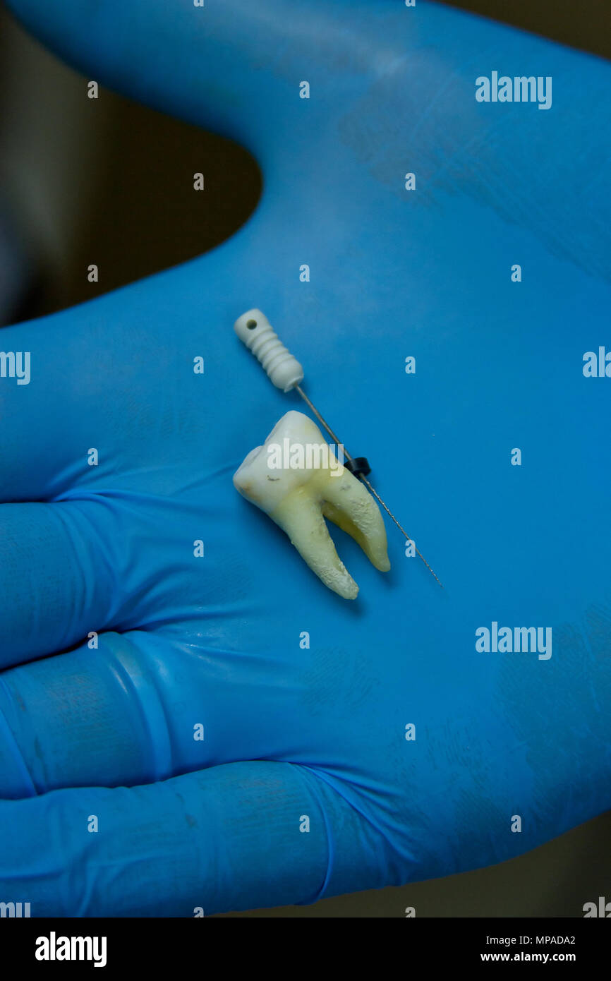 Pull out a tooth hi-res stock photography and images - Alamy