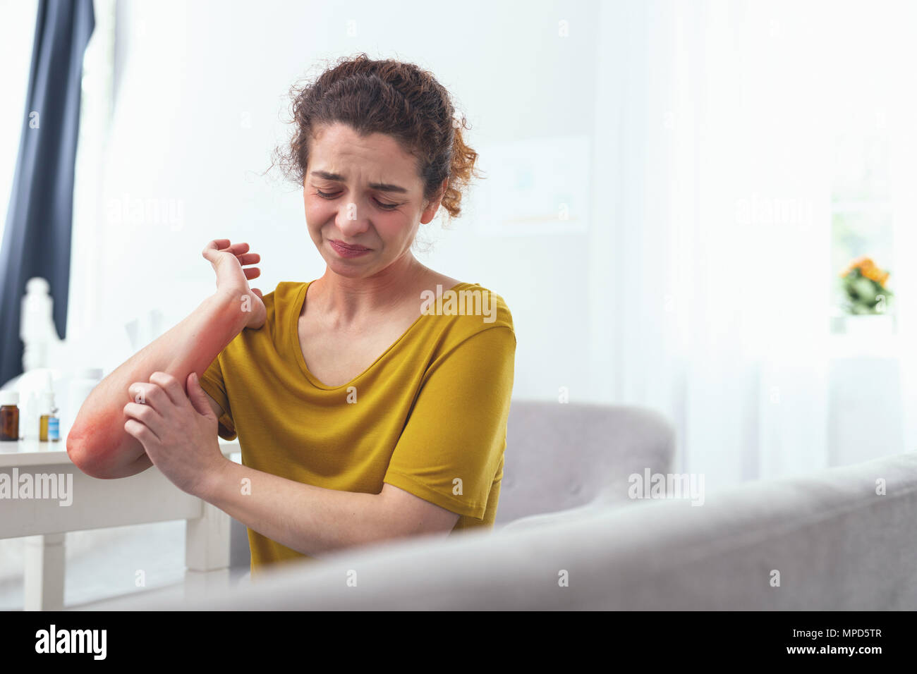 Female scratching arm hi-res stock photography and images - Alamy