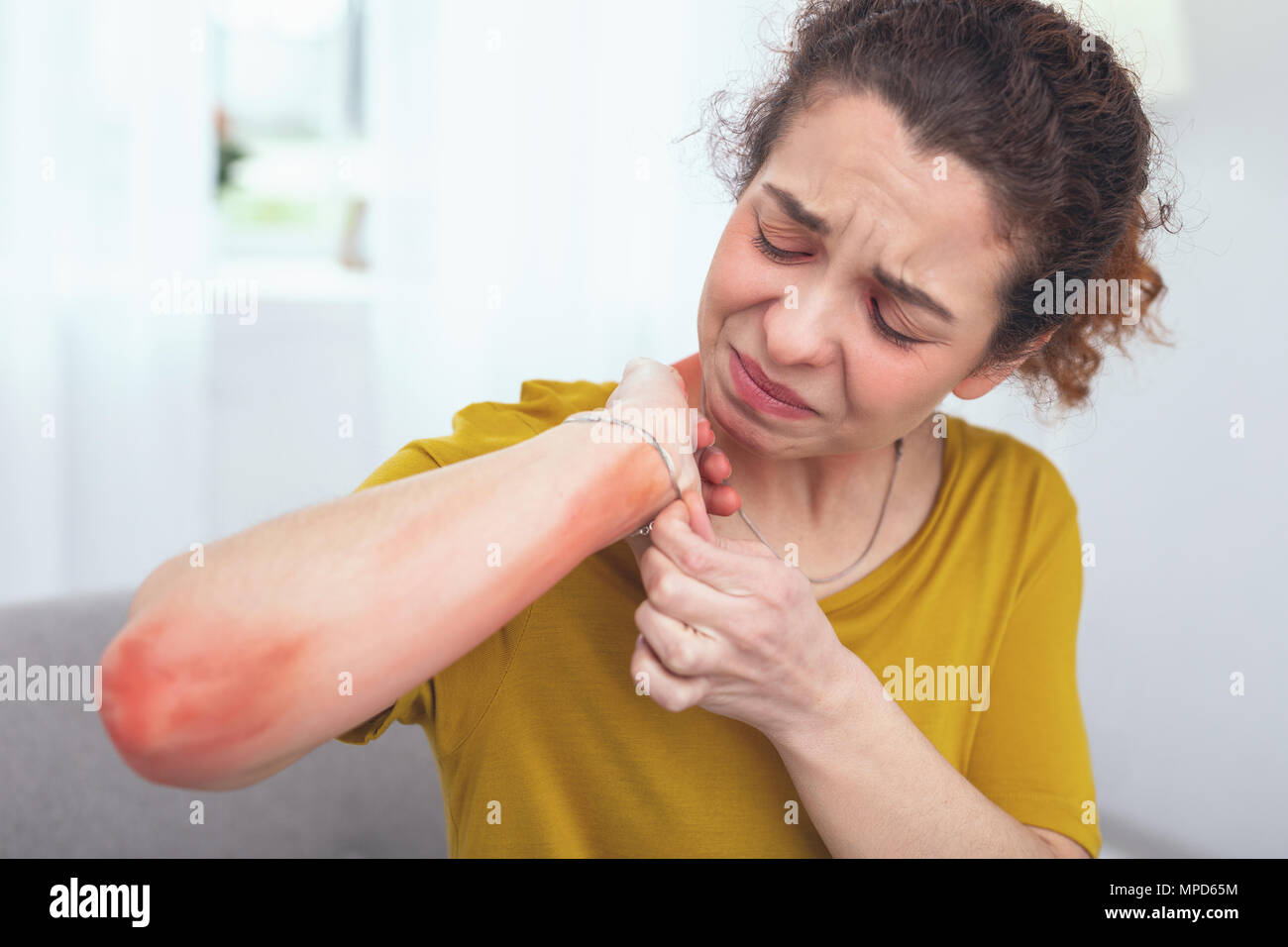 Inflammation condition hi-res stock photography and images - Alamy