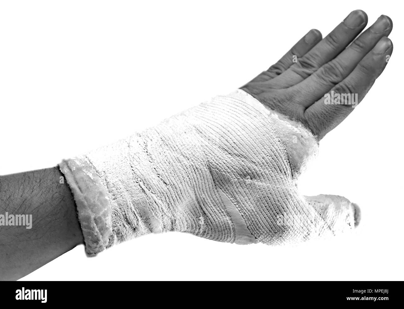 Broken thumb hi-res stock photography and images - Alamy
