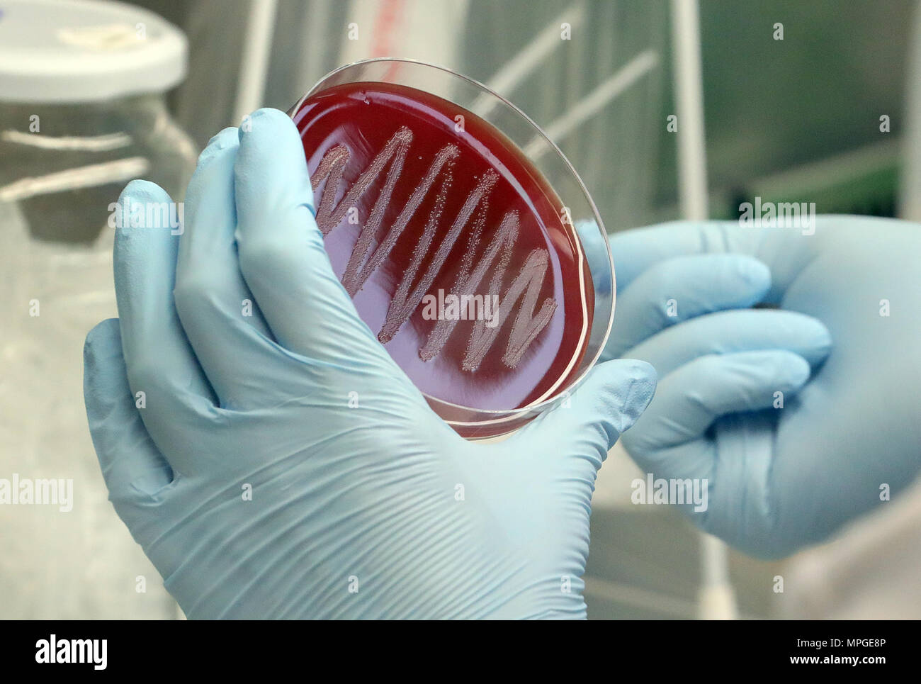 Streptococcus pyogenes hi-res stock photography and images - Alamy