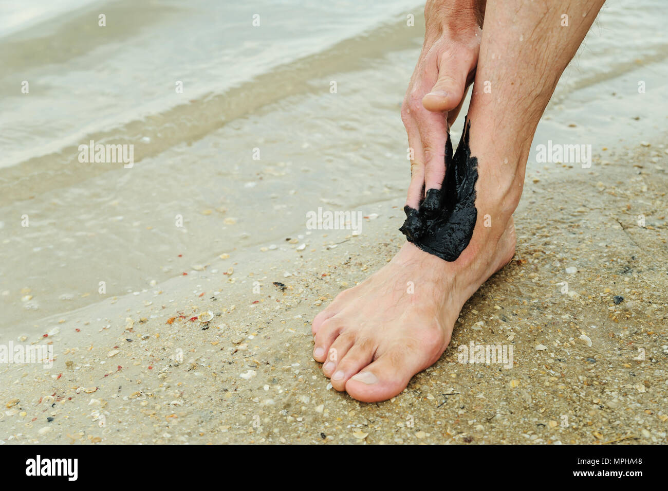 Man applies black therapeutic mud on the ankle Stock Photo - Alamy