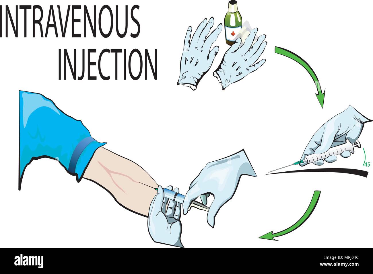Intravenous injection hi-res stock photography and images - Alamy