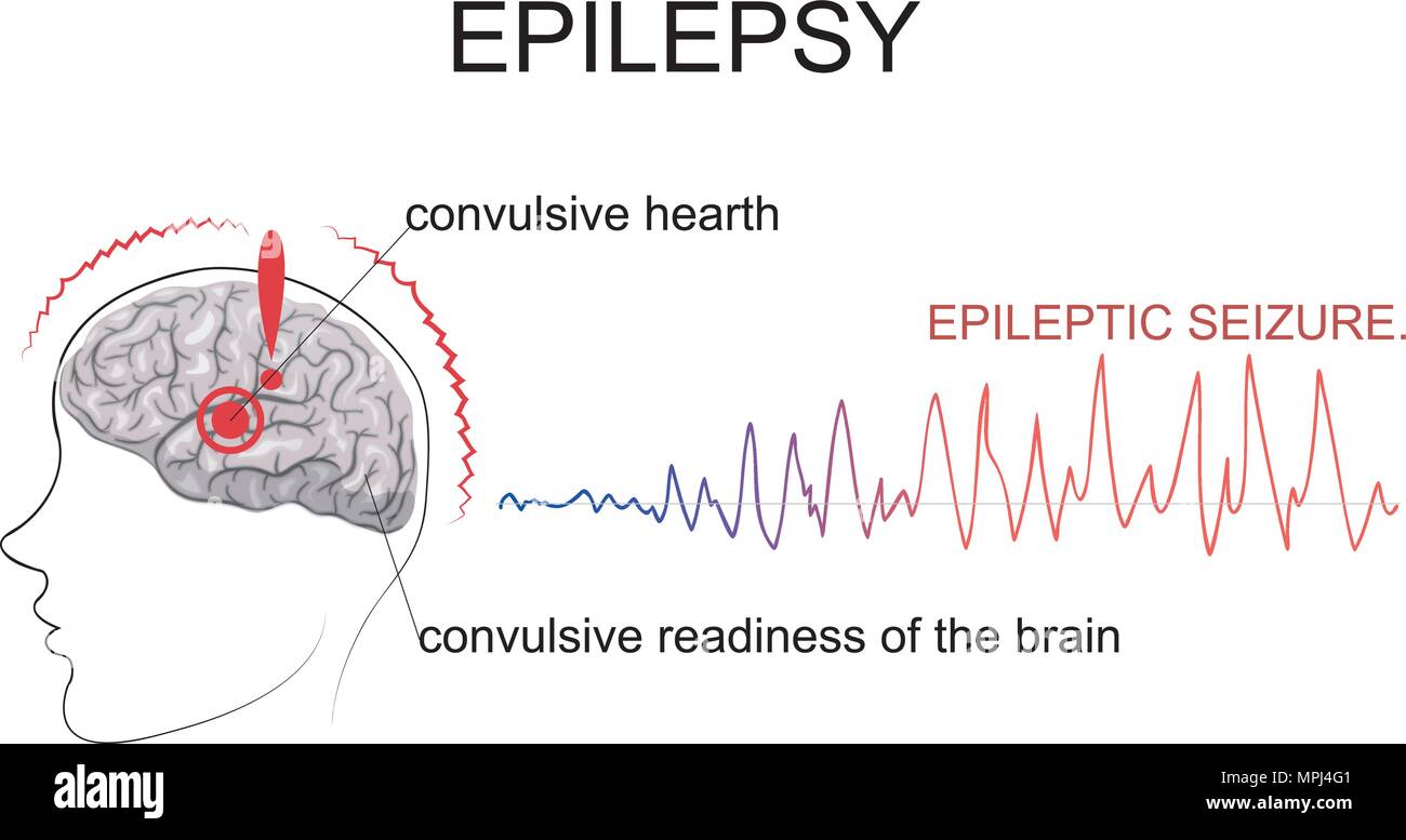 General pathology Stock Vector Images - Alamy
