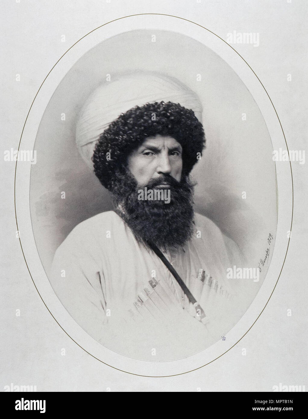 Shamil Basayev Amputation