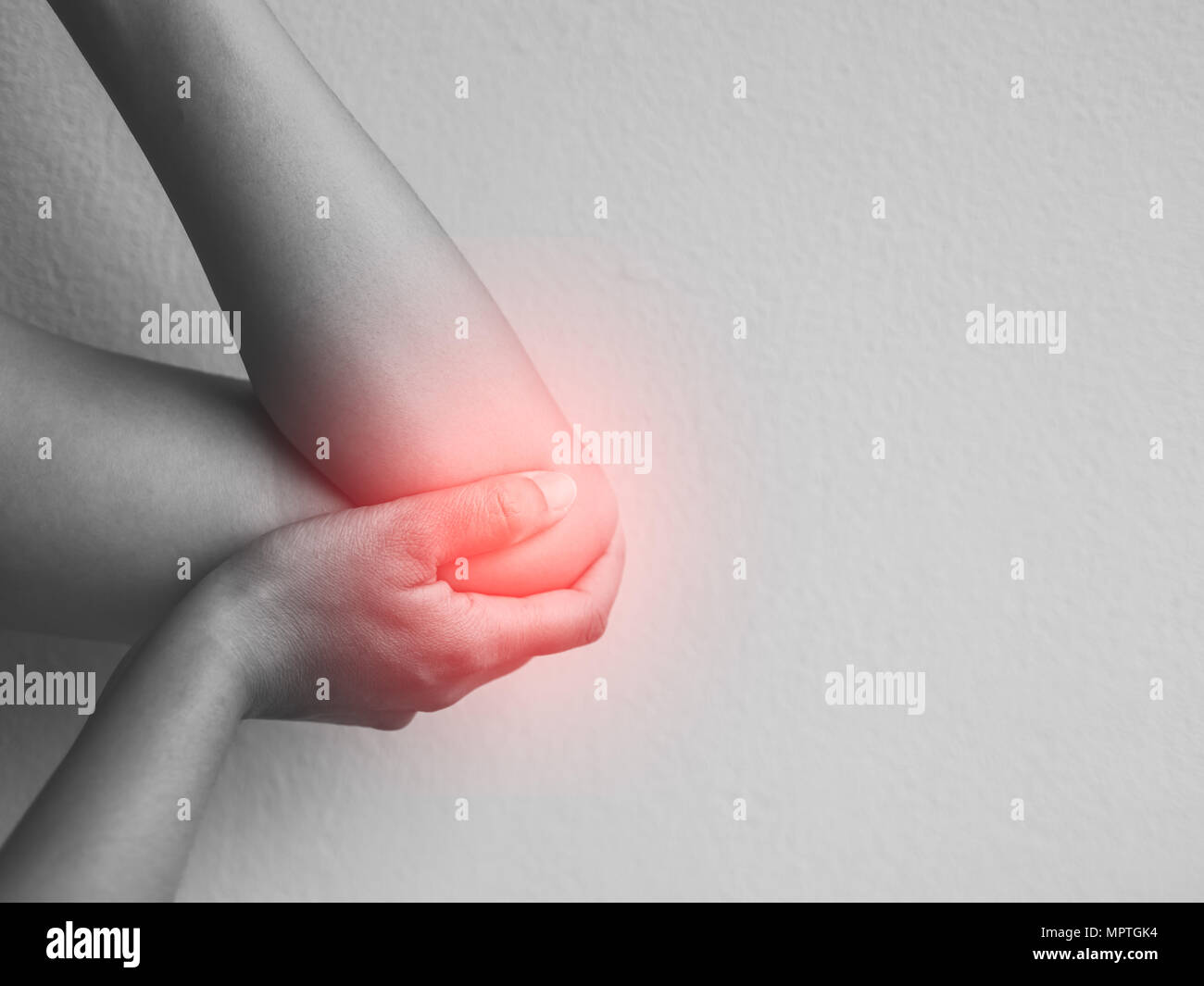 Arm bursitis hi-res stock photography and images - Alamy