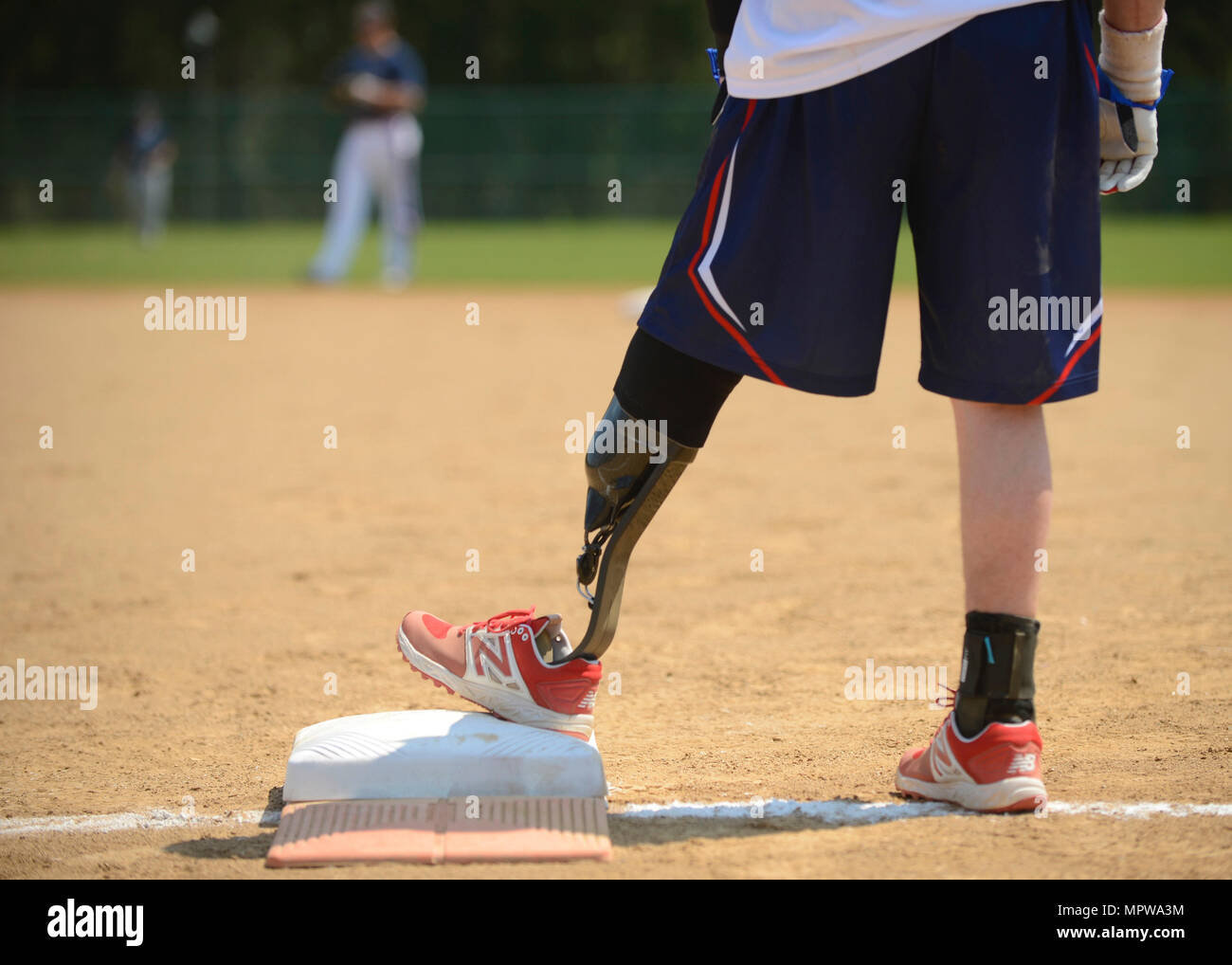 Below elbow amputation hi-res stock photography and images - Alamy