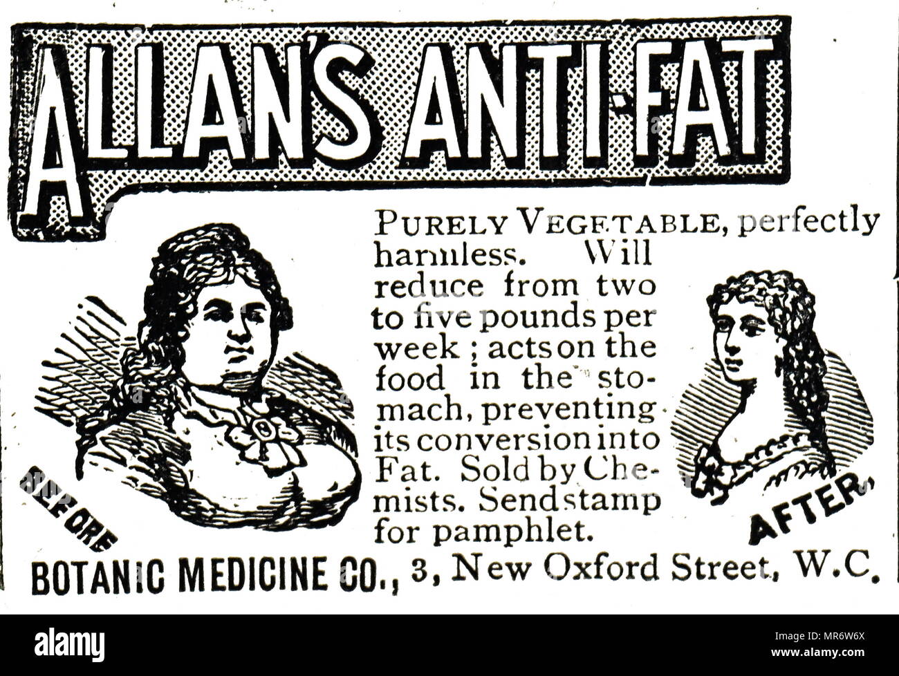 Advertisement for Allan's Anti-Fat - which claimed to be of one hundred ...