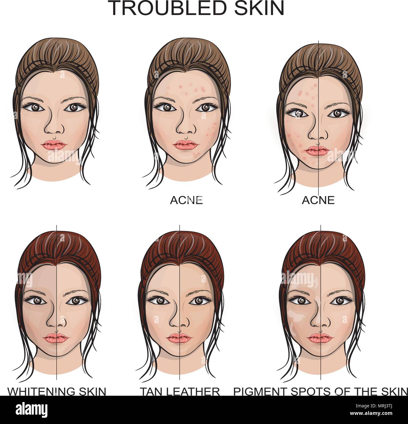 illustration of healthy and problematic skin. vector Stock Vector Image ...