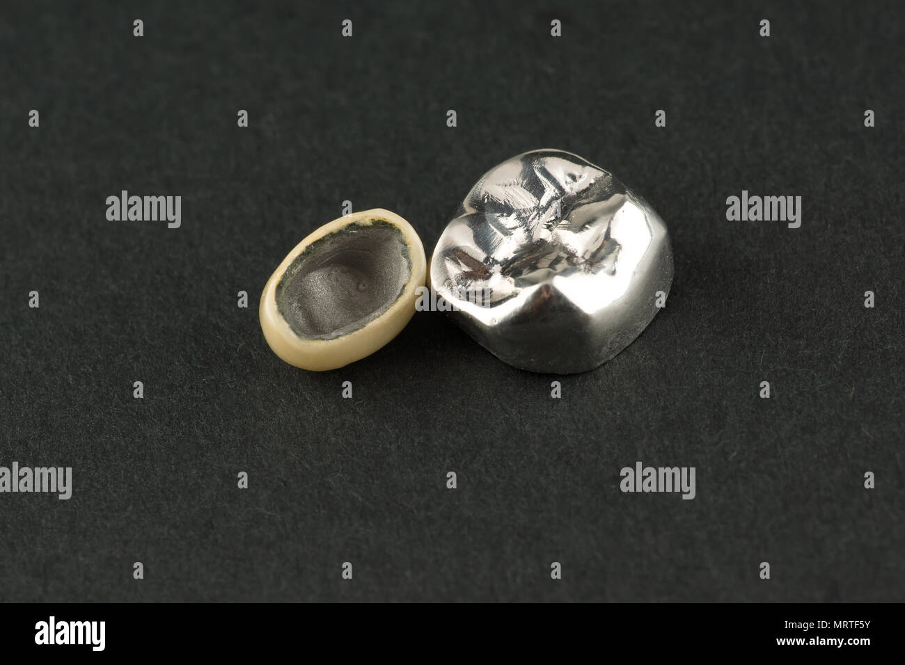 cast and cermet dental structures for restoration of teeth Stock Photo ...