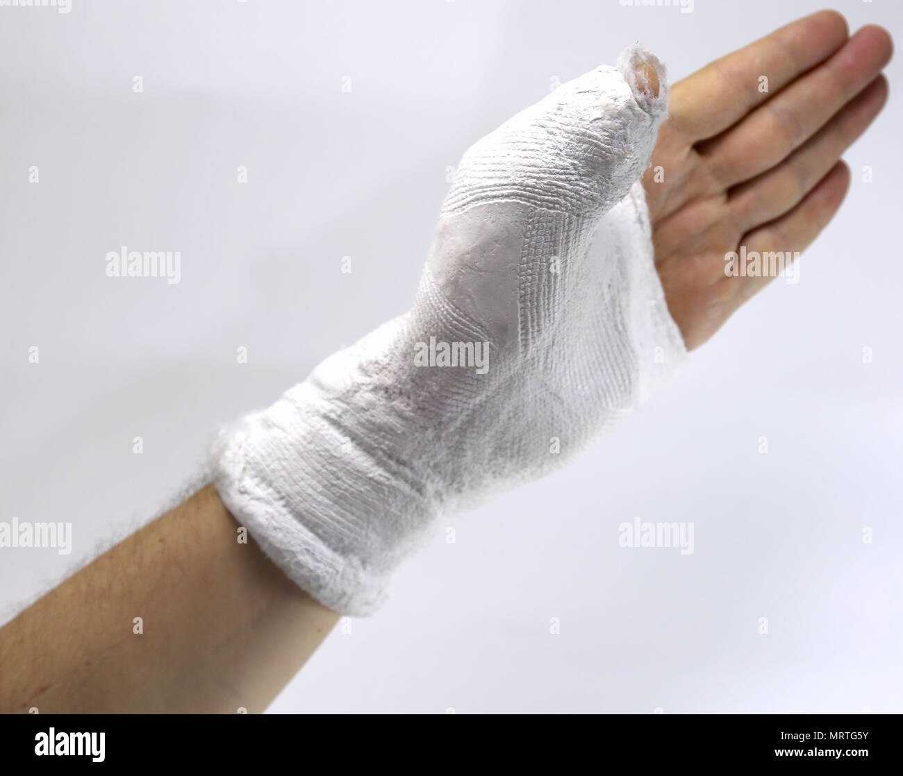 injured person with the broken limb after the car accident Stock Photo ...