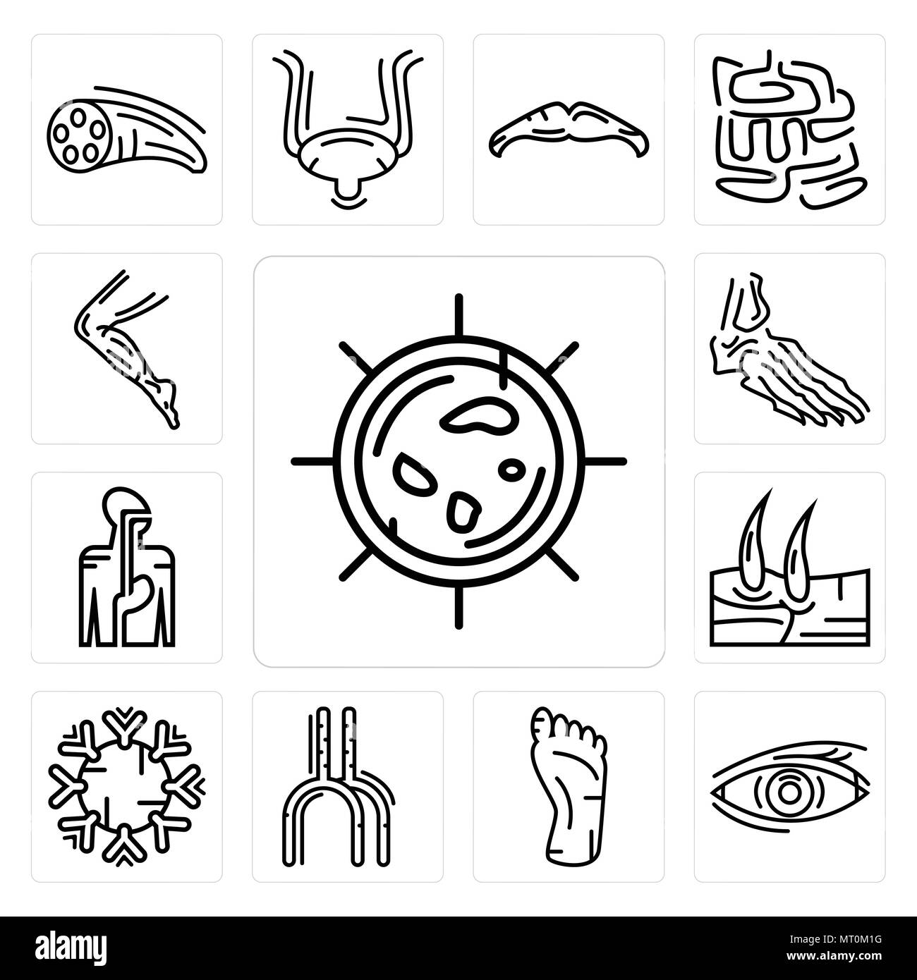 Cellulitis and foot hi-res stock photography and images - Alamy