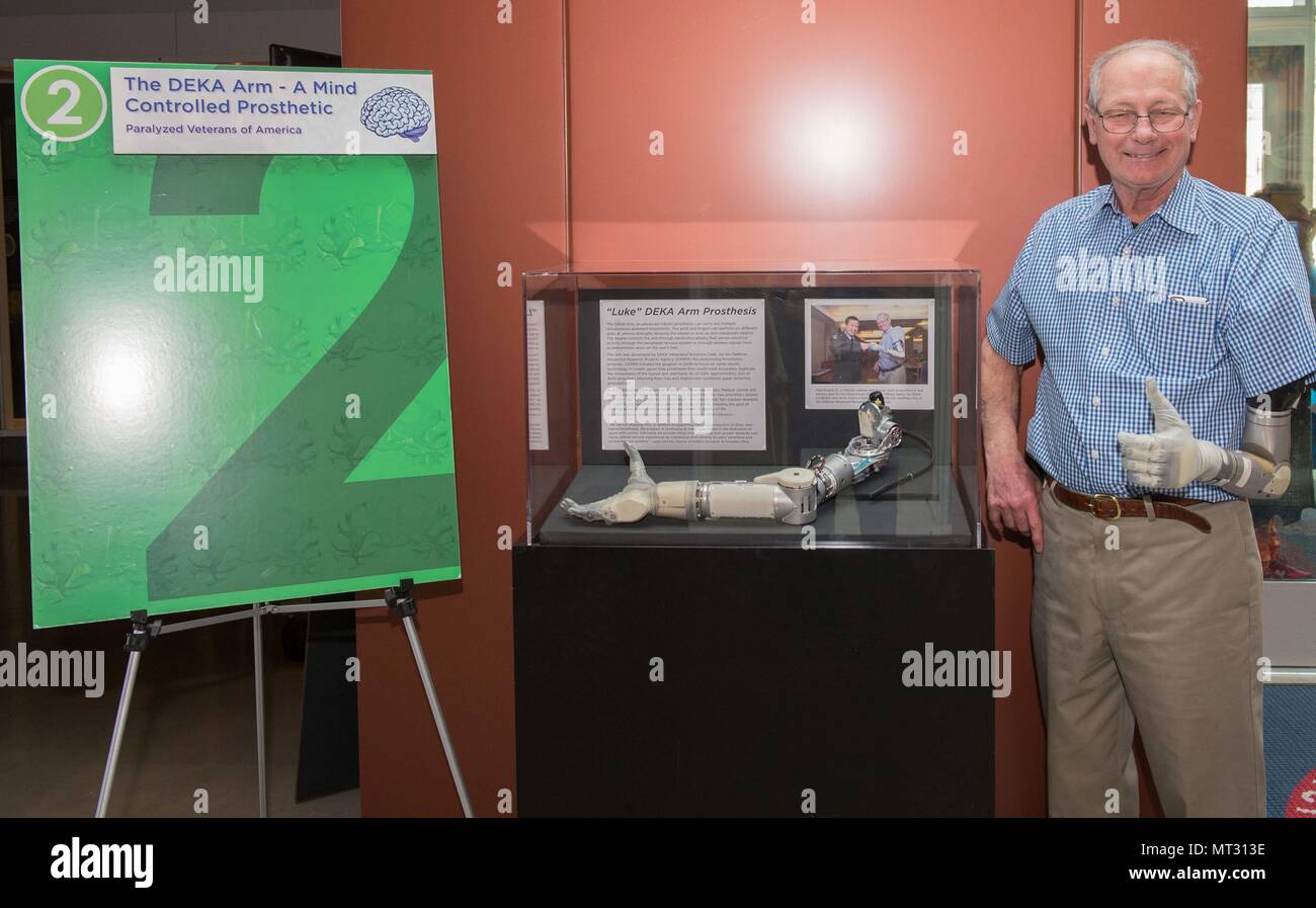 Prosthetic arm developed hi-res stock photography and images - Alamy