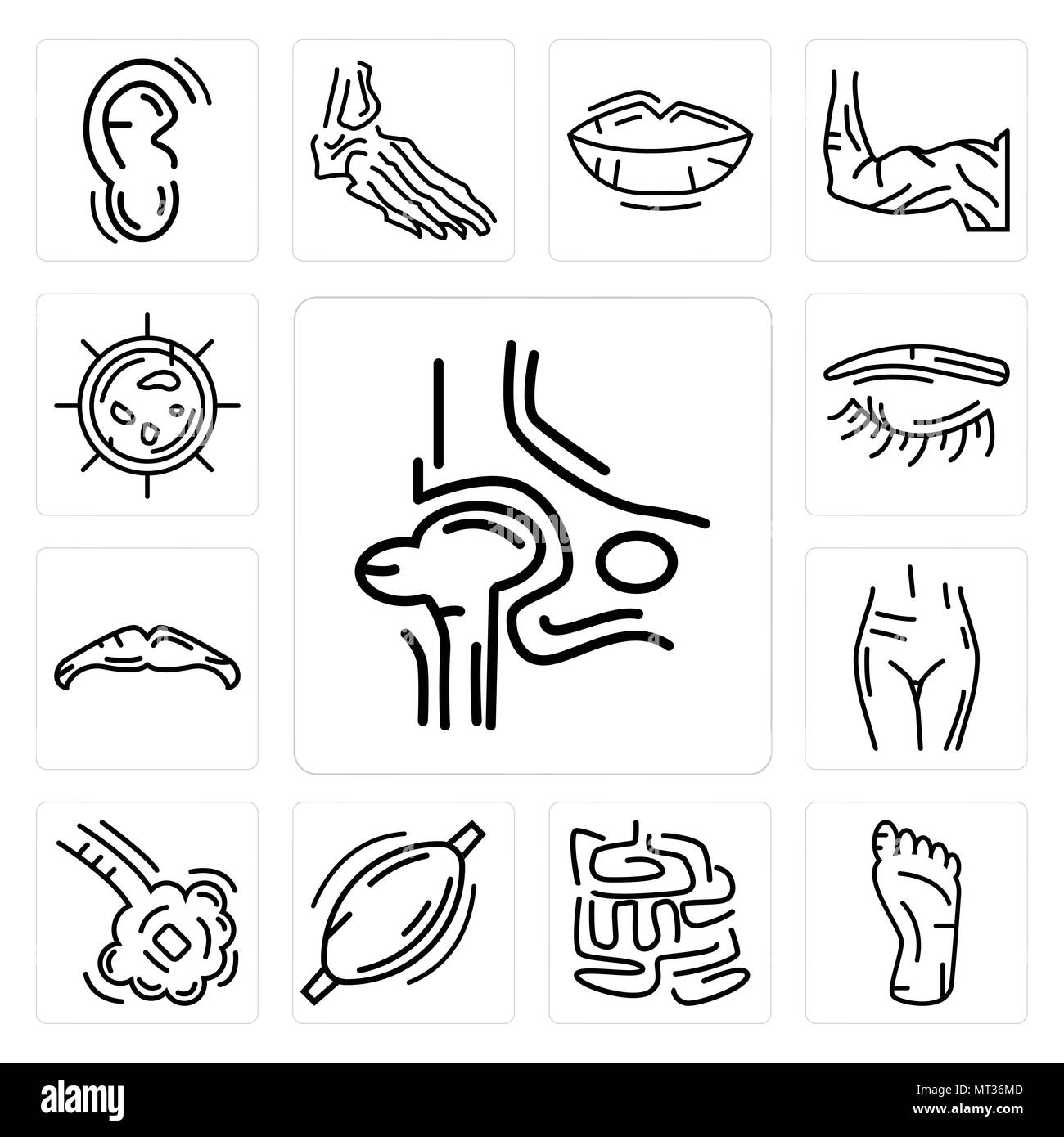 Cellulitis and foot Black and White Stock Photos & Images - Alamy