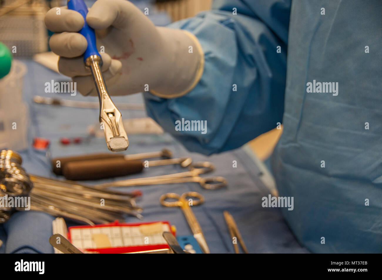 A prosthetic cervical disc is shown during a multilevel hybrid cervical ...