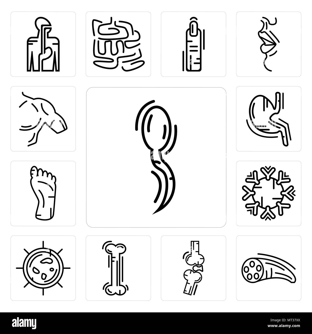 Cellulitis and foot hi-res stock photography and images - Alamy