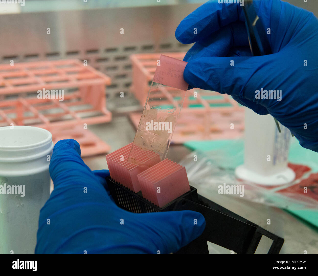 Cytology smear hi-res stock photography and images - Alamy