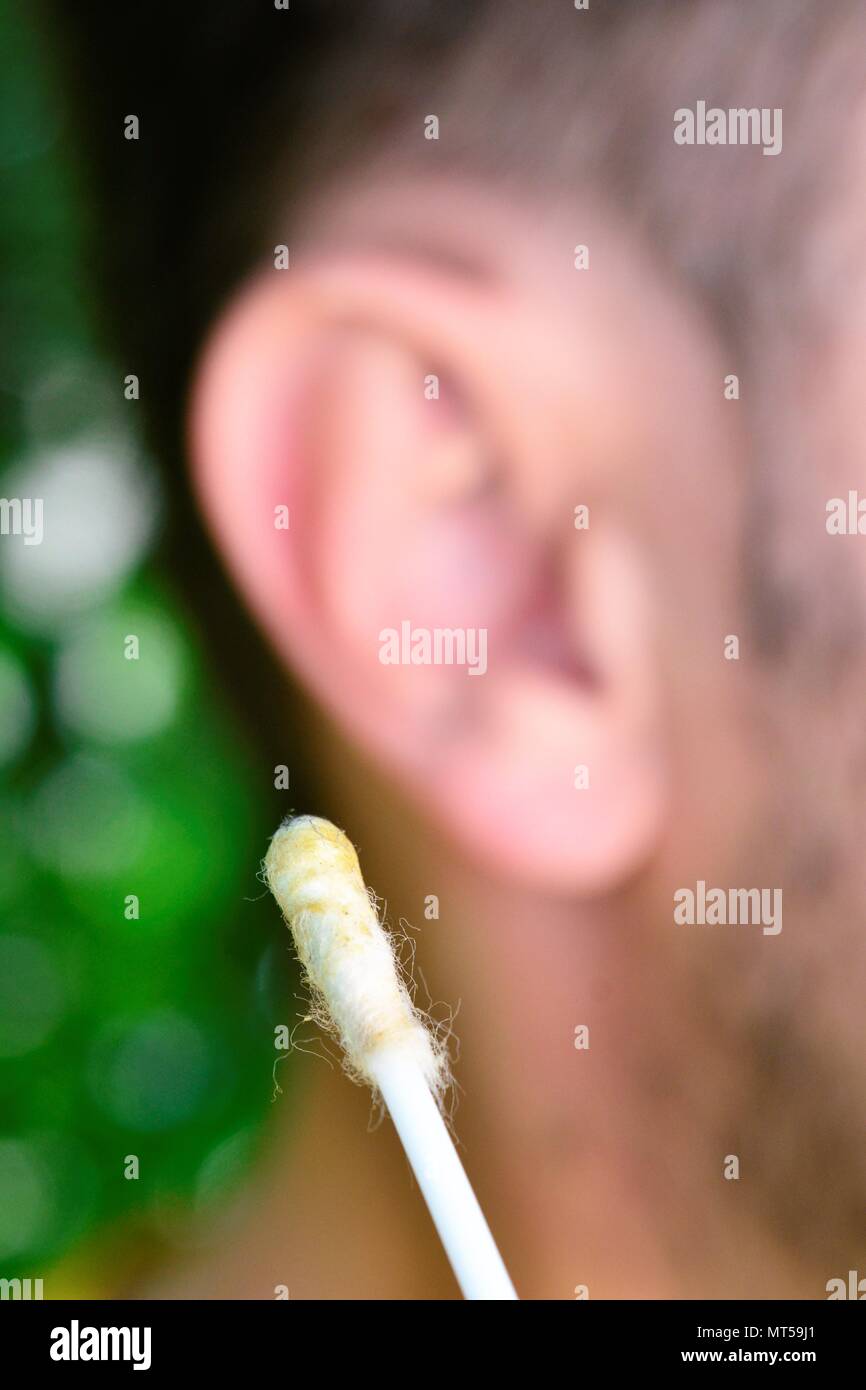 Ear wax hi-res stock photography and images - Alamy