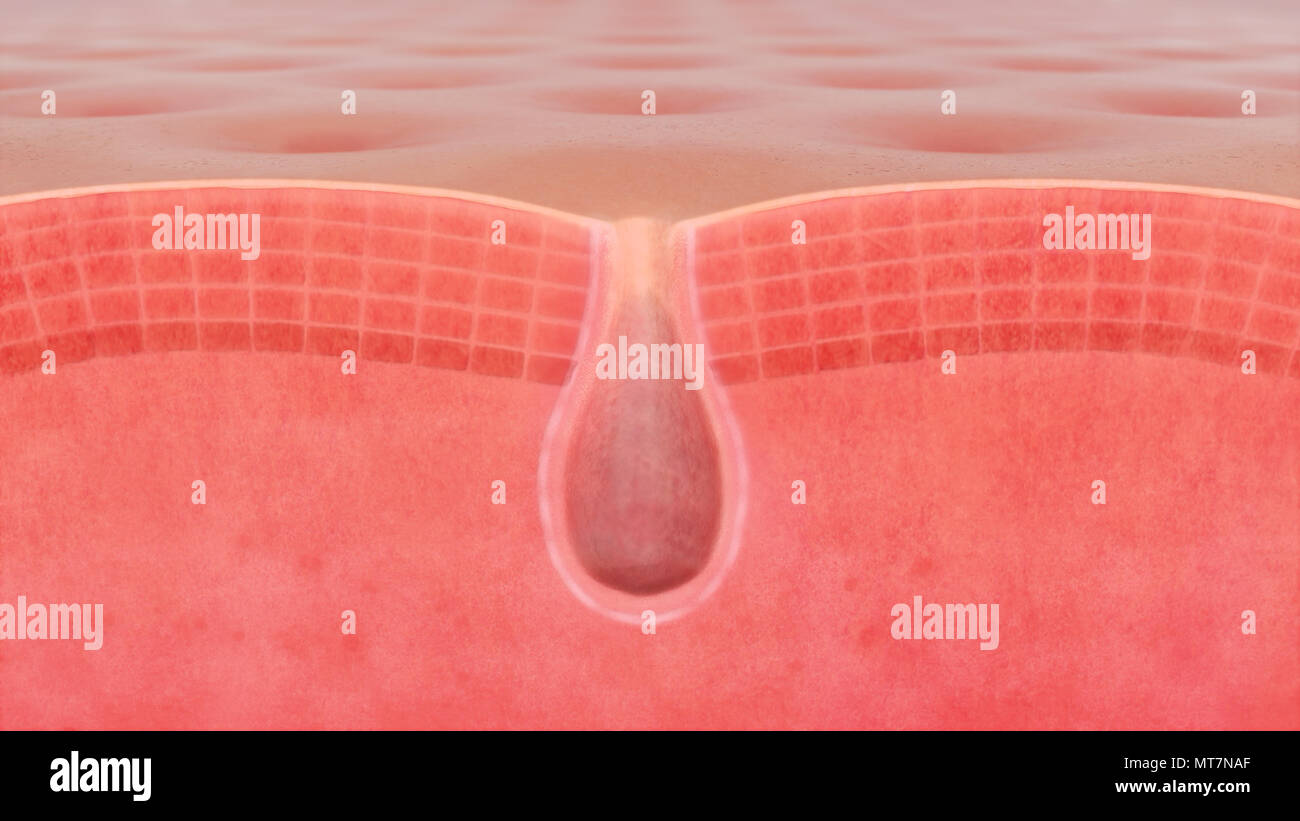 3D illustration of a skin pore Stock Photo - Alamy