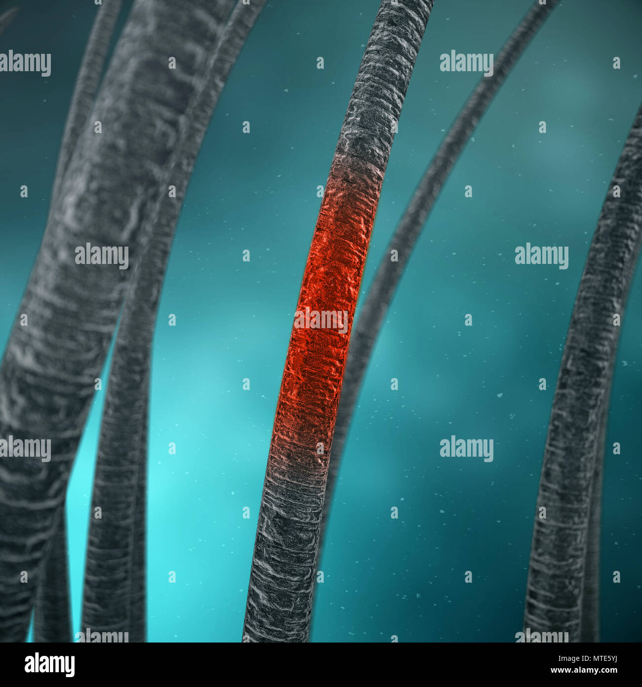 Microscopic Hair Stock Photos & Microscopic Hair Stock Images - Alamy