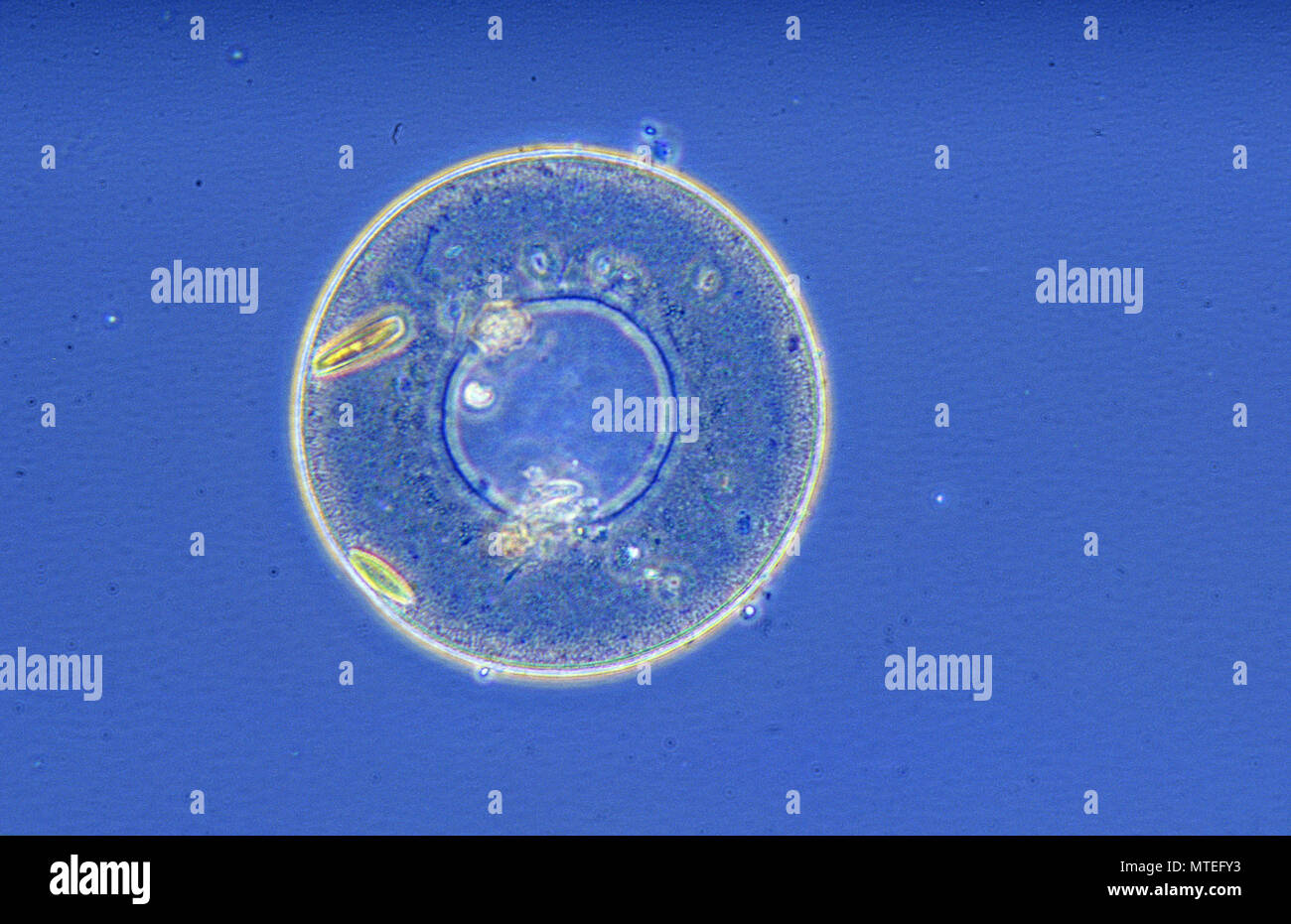 Arcella amoeba hi-res stock photography and images - Alamy