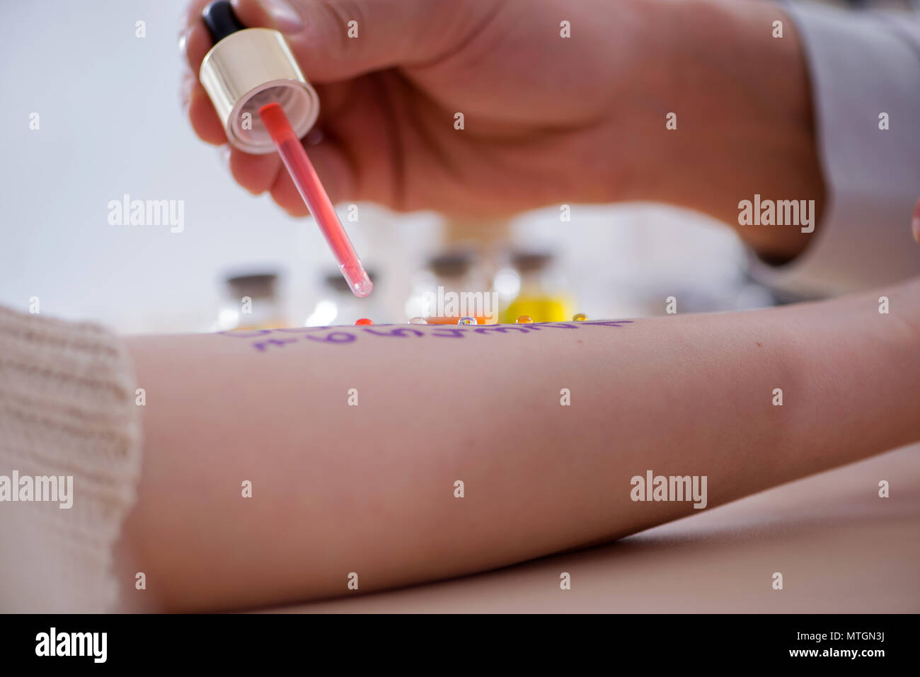 Doctor testing allergy reaction of patient in hospital Stock Photo - Alamy