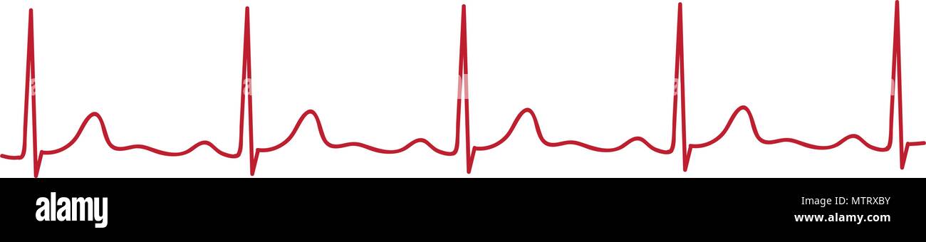Electrocardiogram graph ekg heart rhythm hi-res stock photography and ...